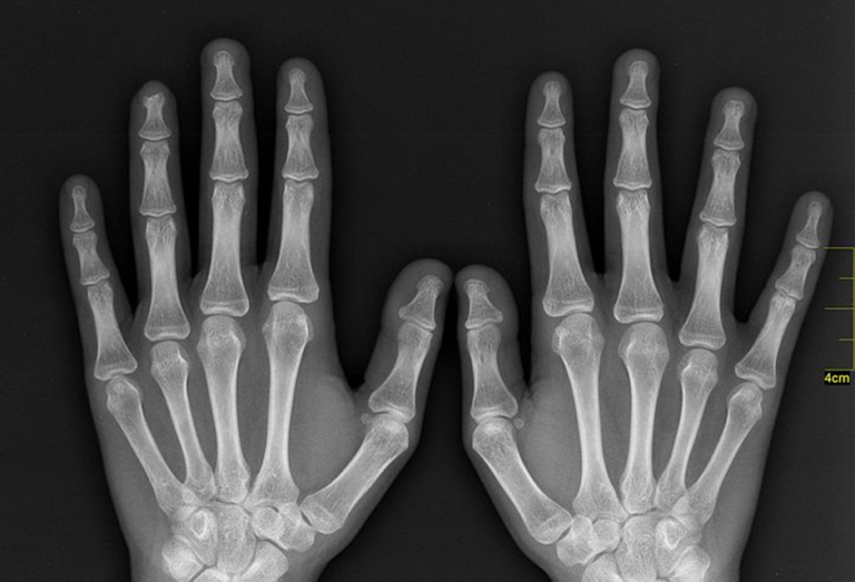 X-Rays vs. MRIs for Pain Diagnosis: Choosing the Right Imaging ...