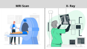 The Role of X-Rays and MRIs in Pain Management: What to Expect ...