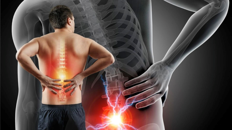 Living with Chronic Sciatica: Strategies for Long-Term Pain Management - Orlovich Pain MD