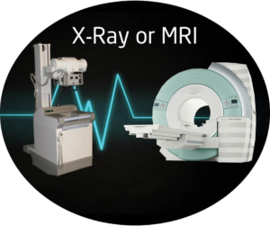MRI or X-ray: Which is Better for Soft Tissue Injuries? - Orlovich Pain MD