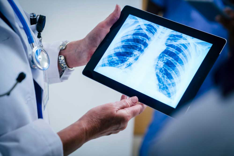 MRI or X-ray: Which is Better for Soft Tissue Injuries? - Orlovich Pain MD