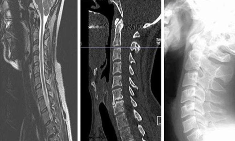 MRI or X-ray: Which is Better for Soft Tissue Injuries? - Orlovich Pain MD